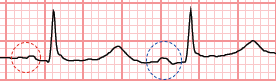Teaching Medicine - Tutorial: Analyze the Waveforms